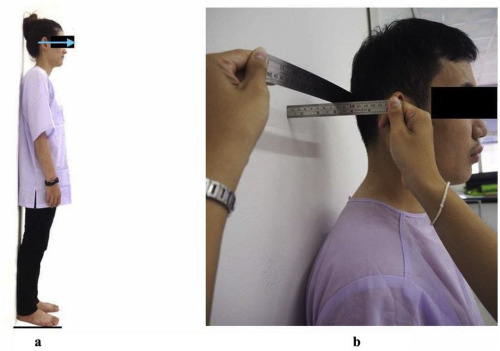 El Test de Flesche - Occiput to Wall Distance OWD - Análisis Completo ...