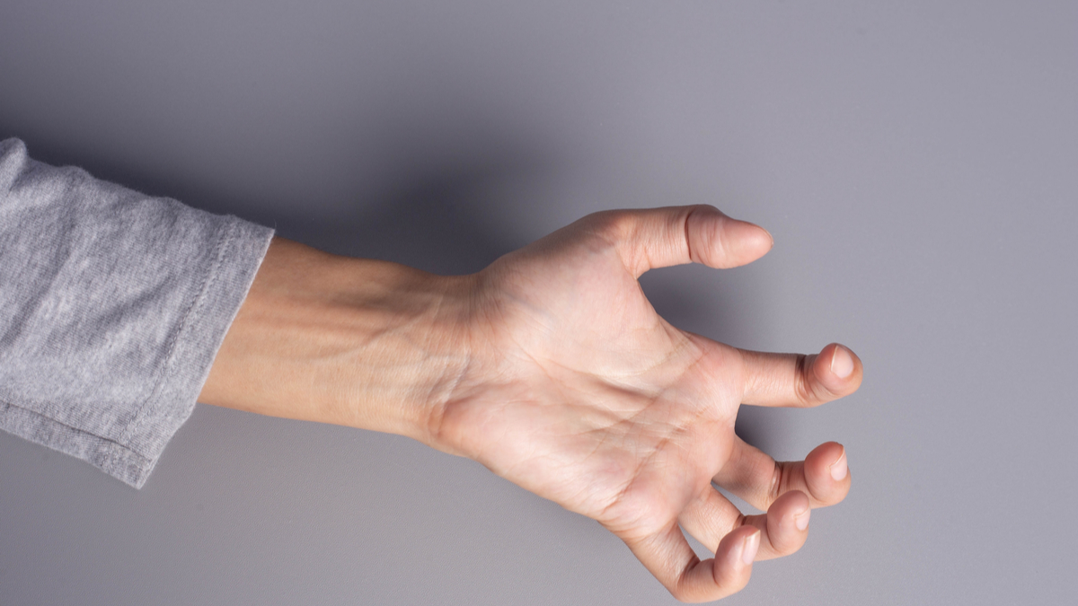 La Escala de Tardieu - Análisis Completo - Recursos de Fisioterapia