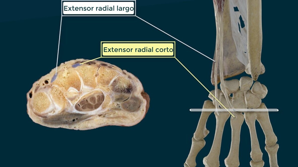 Músculo Extensor Radial Largo del Carpo (Guía Anatómica) - Recursos de ...