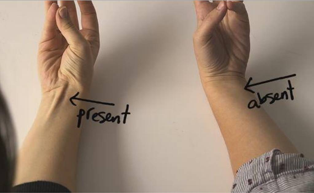 Músculo Palmar Largo (Guía Anatómica) - Recursos de Fisioterapia