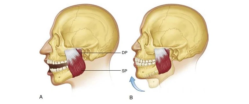 Músculo Masetero (Guía Anatómica) - Recursos de Fisioterapia